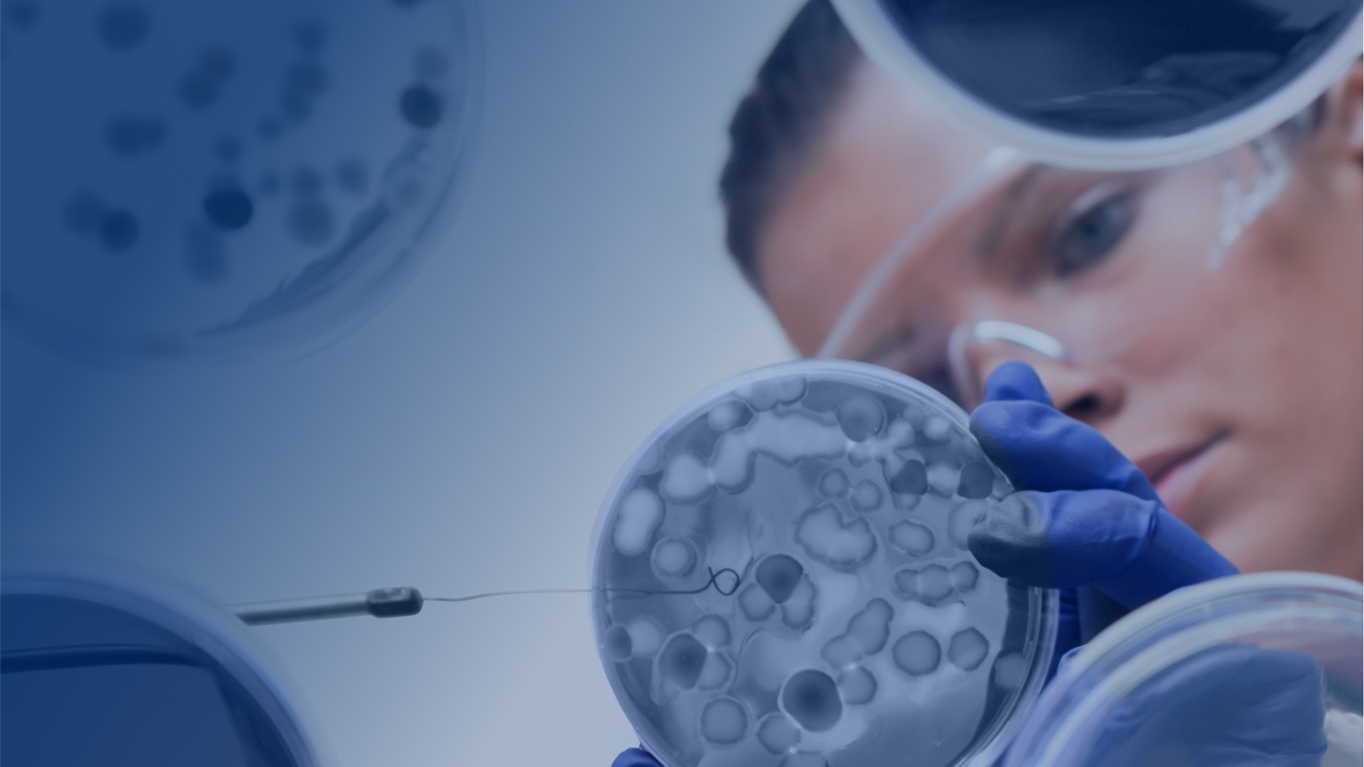 IBSA Foundation - Fellowships 2024 Call